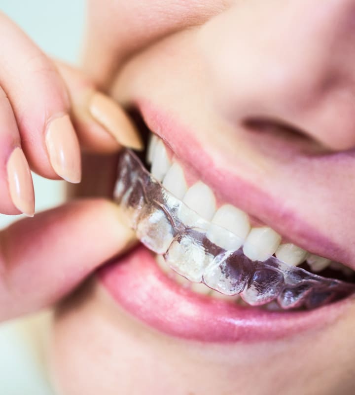 Invisiline System - Studio Odontoiatrico Associato Bacchini-Monticelli